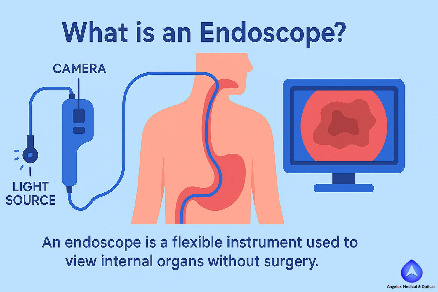 What Is an Endoscope? Uses, Types & How It Works Explained