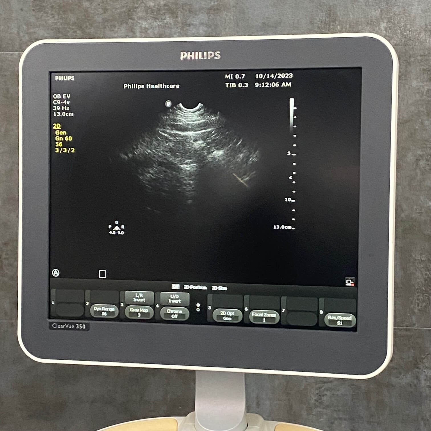 Phillips Ultrasound Transducers for ClearVue