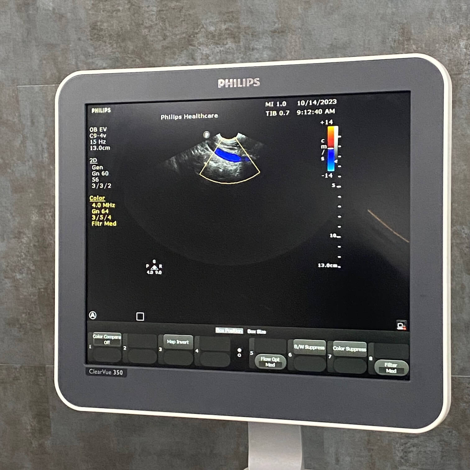 Phillips Ultrasound Transducers for ClearVue - – Angelus Medical and ...
