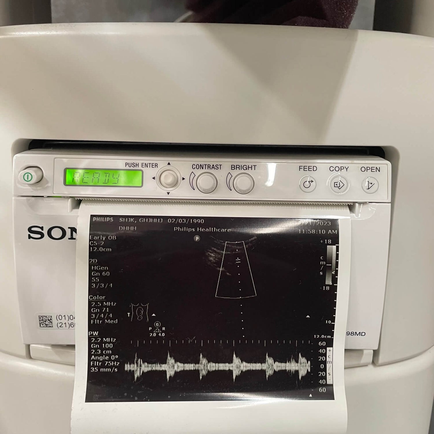 Philips ClearVue 350 Ultrasound - – Angelus Medical and Optical