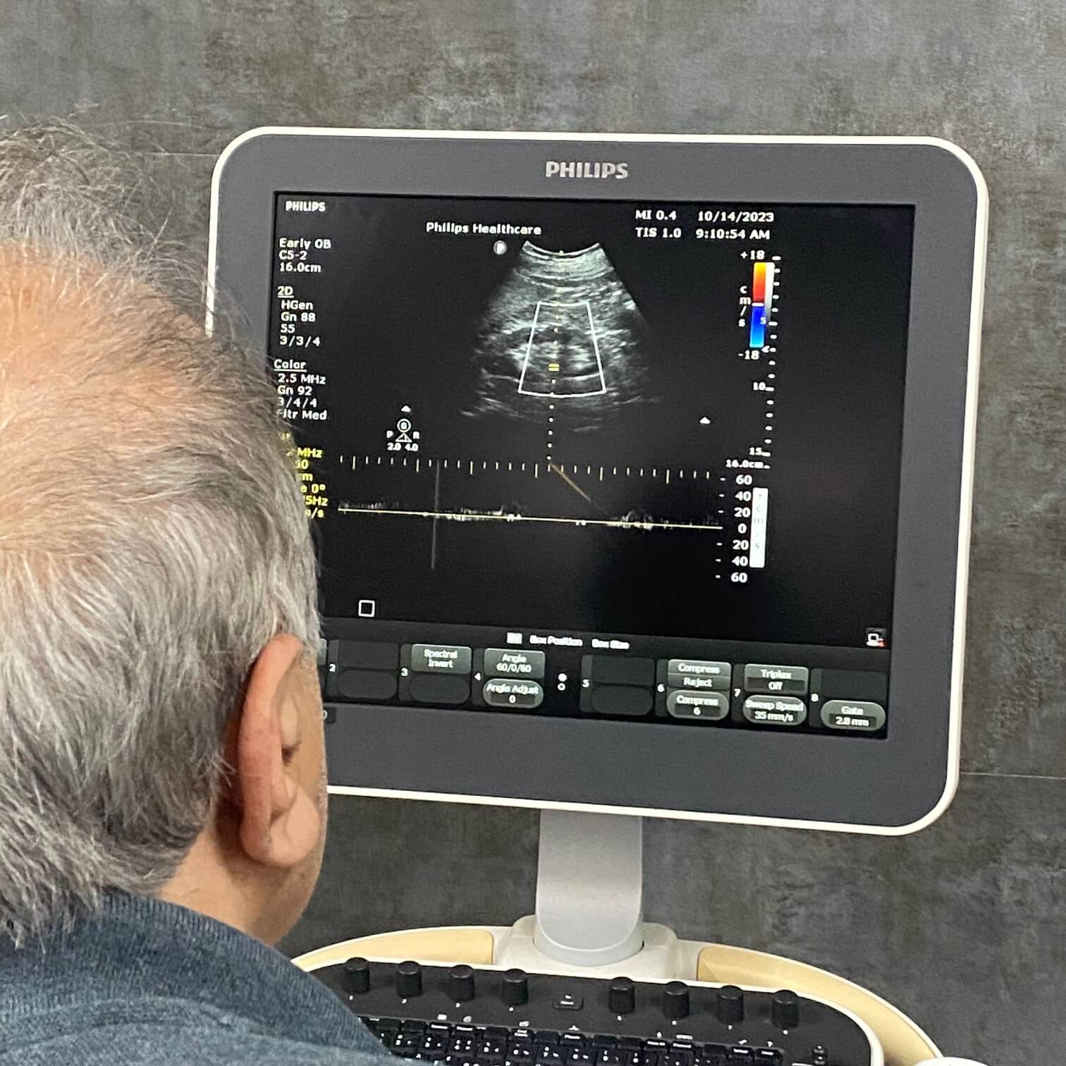 Philips ClearVue 350 Ultrasound