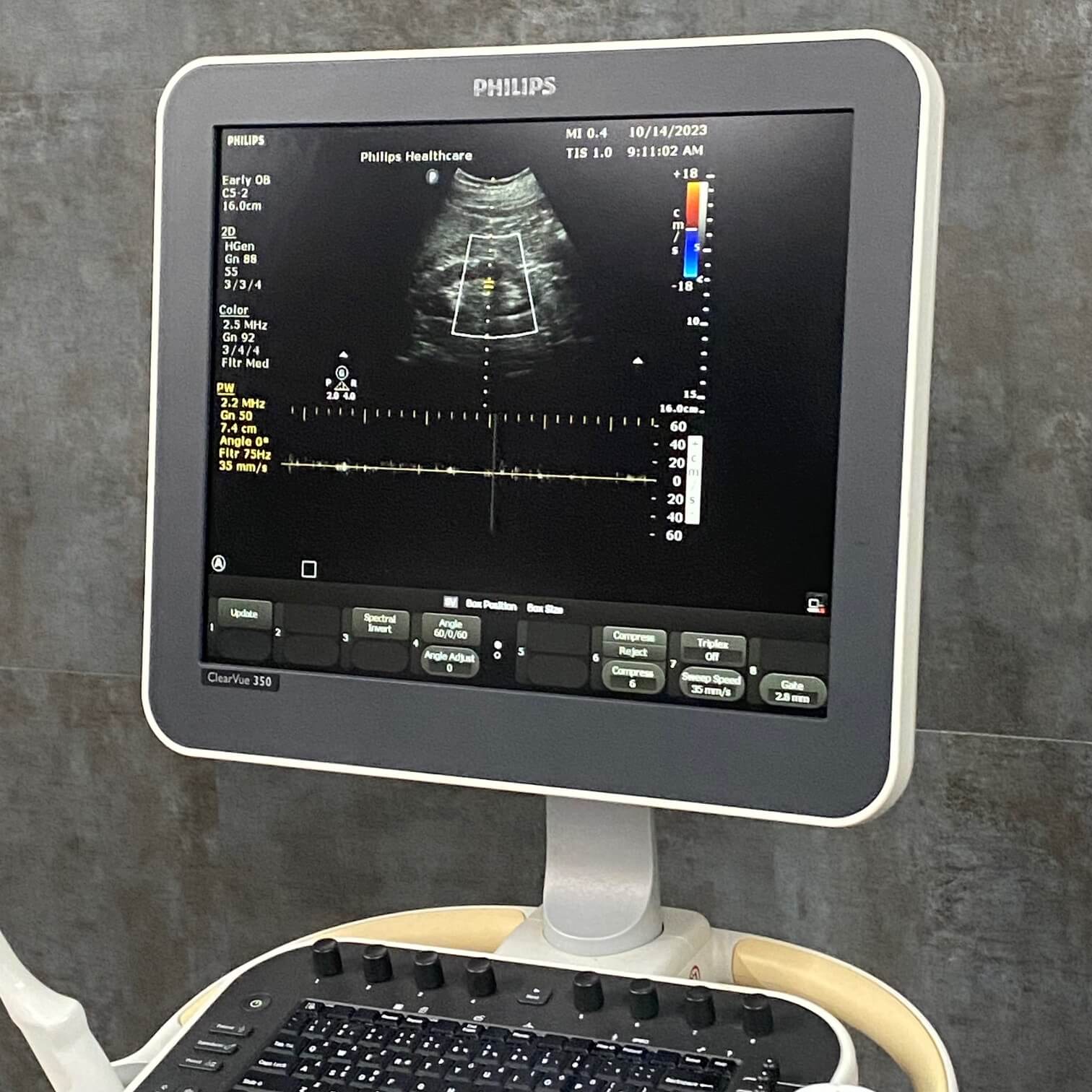 Philips ClearVue 350 Ultrasound
