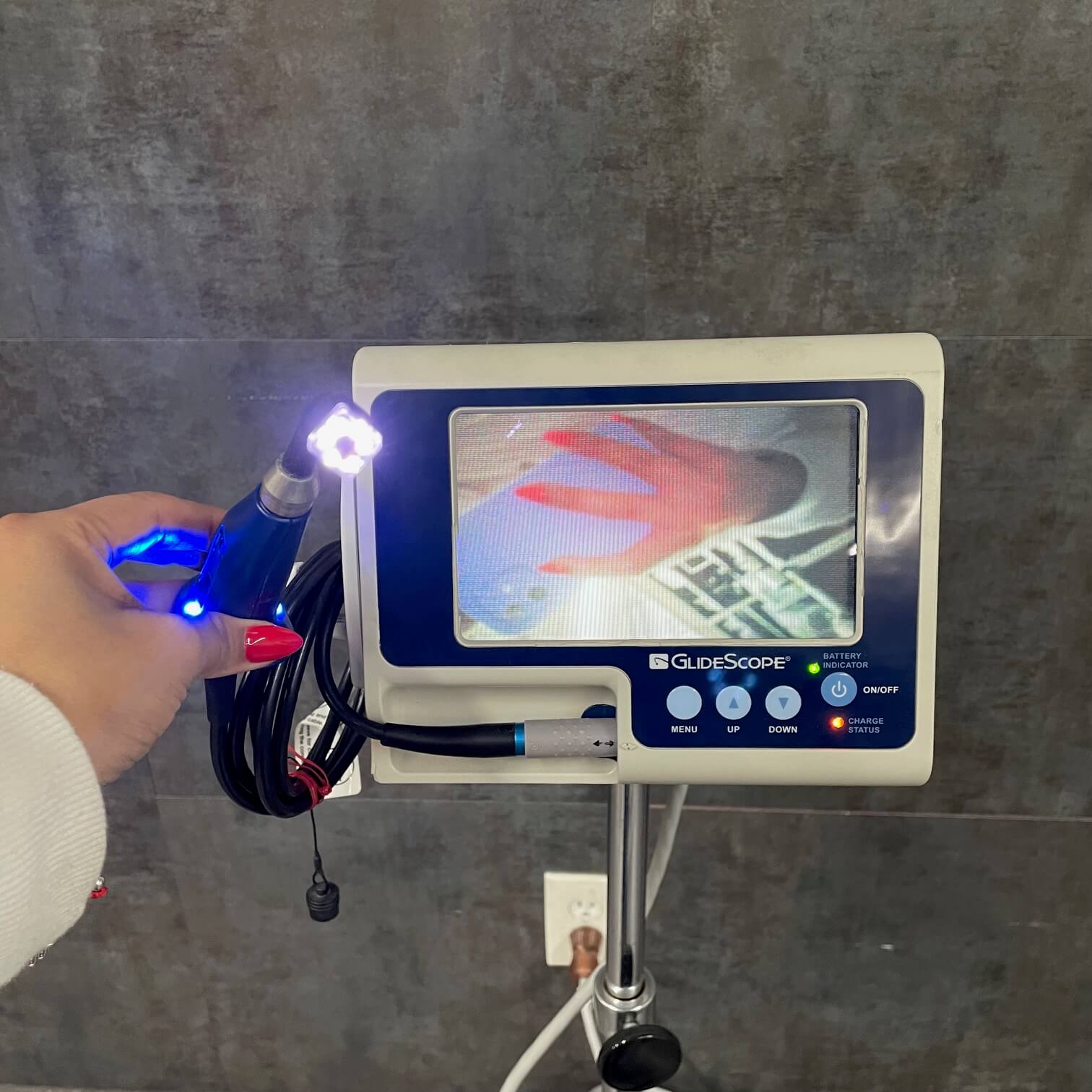 Verathon portable GVL video laryngoscope