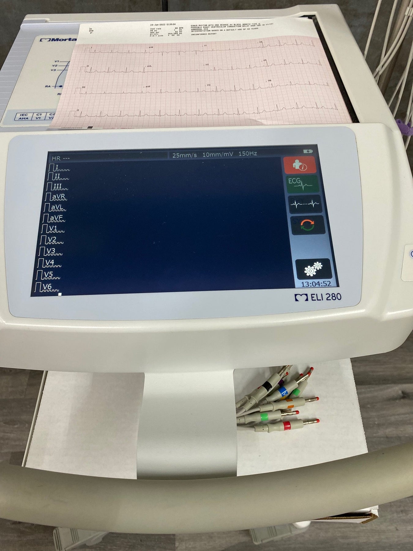 Burdick ELI 280,Wireless ECG,wireless ekg,burdick ecg – Angelus Medical ...