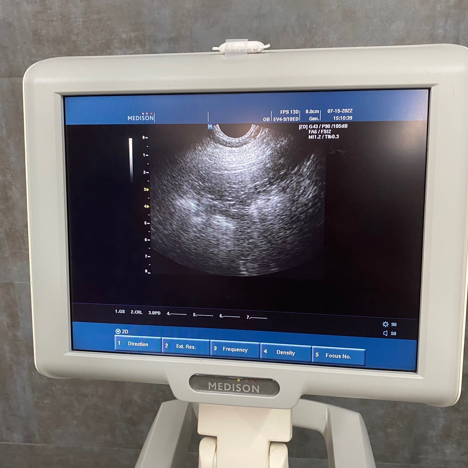 Samsong Medison SonoAce X6 Ultrasound