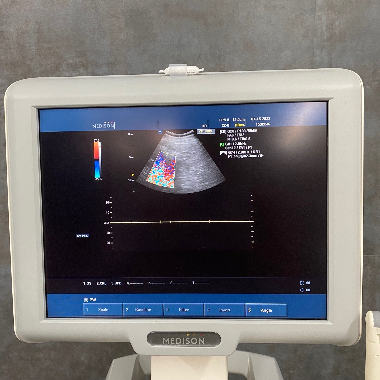 Samsong Medison SonoAce X6 Ultrasound