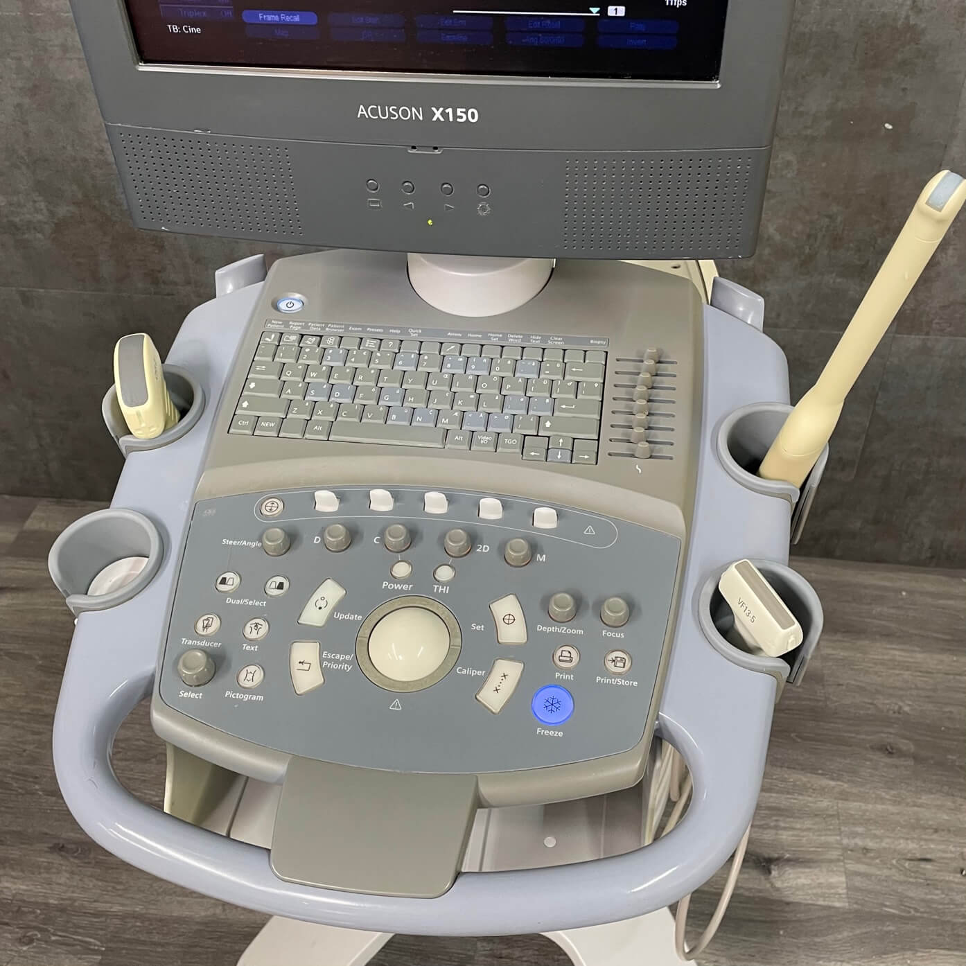 Siemens Acuson X150 Diangostic Ultrasound